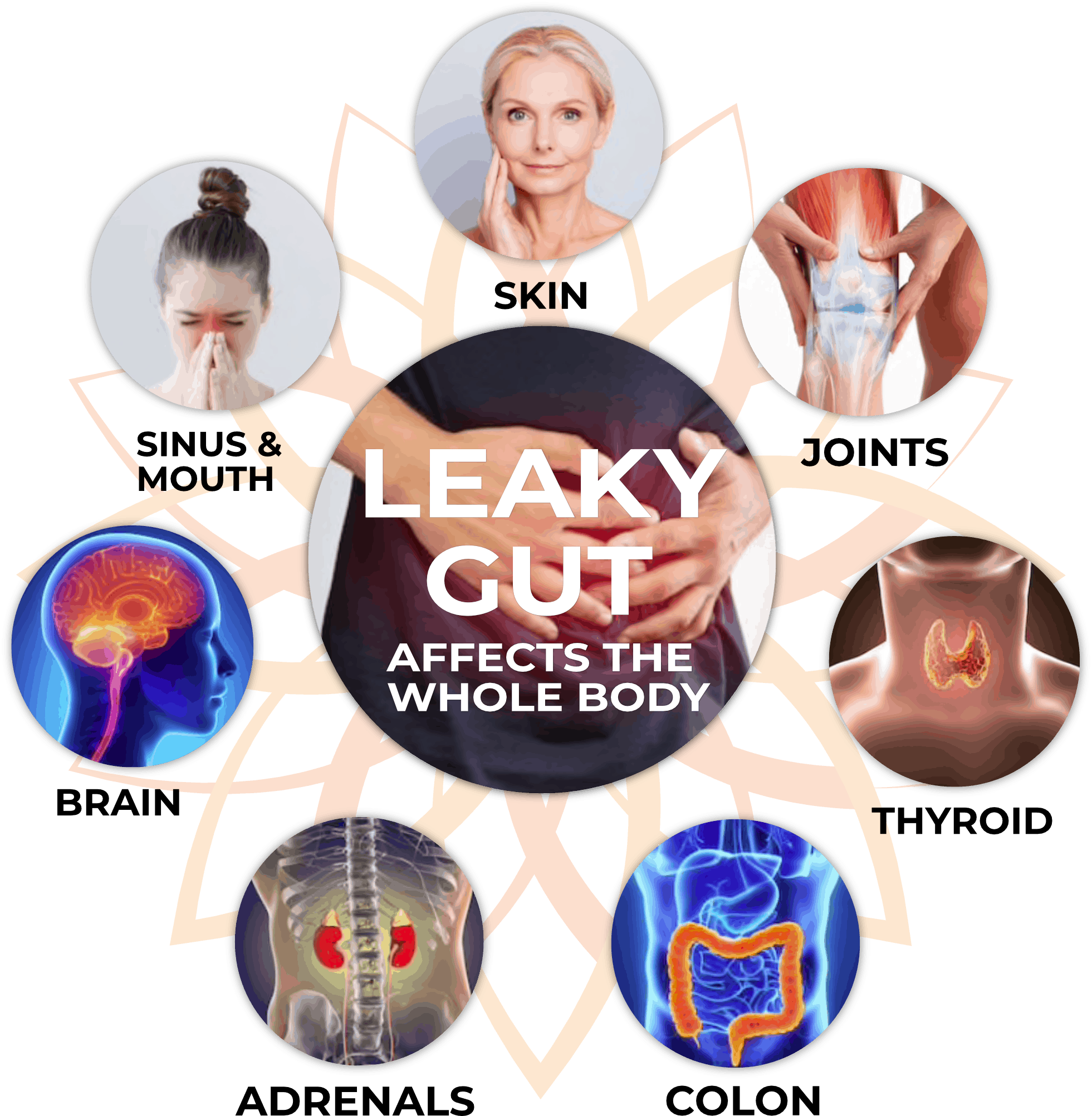 Did you know that leaky gut syndrome affects your entire body and not ...